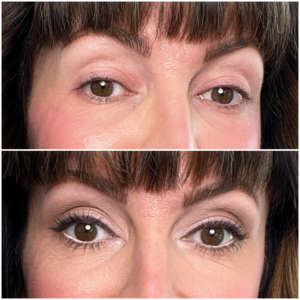 Eyes: Achieve a Youthful Look with These Tips